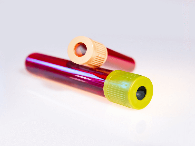 Full Guide to LetsGetChecked Tests | STDWatch.com