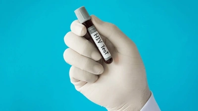 Types of HIV Test, Symptoms and Risk Factors | STDWatch.com
