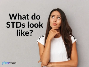 What do STDs look like? | STDWatch.com