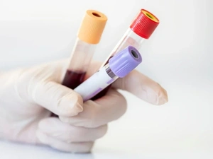 What Are Optimal Pregnenolone Levels? | STDWatch.com