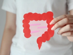 Colon Diseases | STDWatch.com