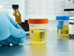 Ureaplasma Testing | STDWatch.com