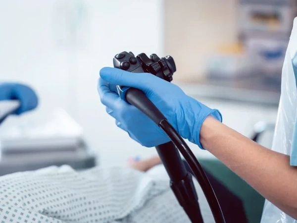 Colon Polyps: Diagnosis & Treatment | STDWatch.com