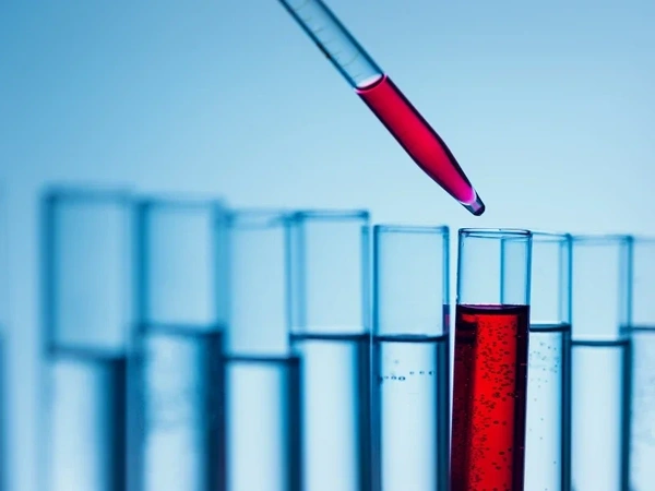 RPR Test: Purpose, Procedure, and Results | STDWatch.com