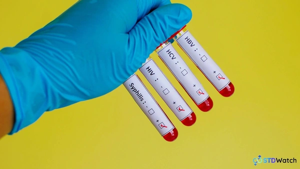 List of the Most Common STDs in the United States | STDWatch.com