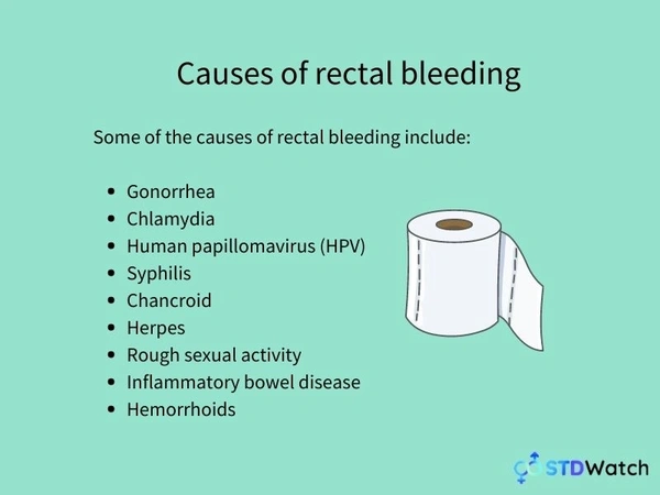 Rectal Bleeding Causes, Treatments & Tests | STDWatch.com
