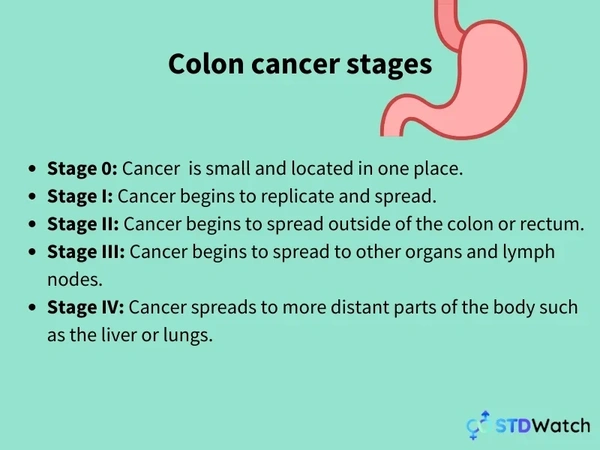 Colon Cancer Stages, Symptoms & Risk Factors | STDWatch.com