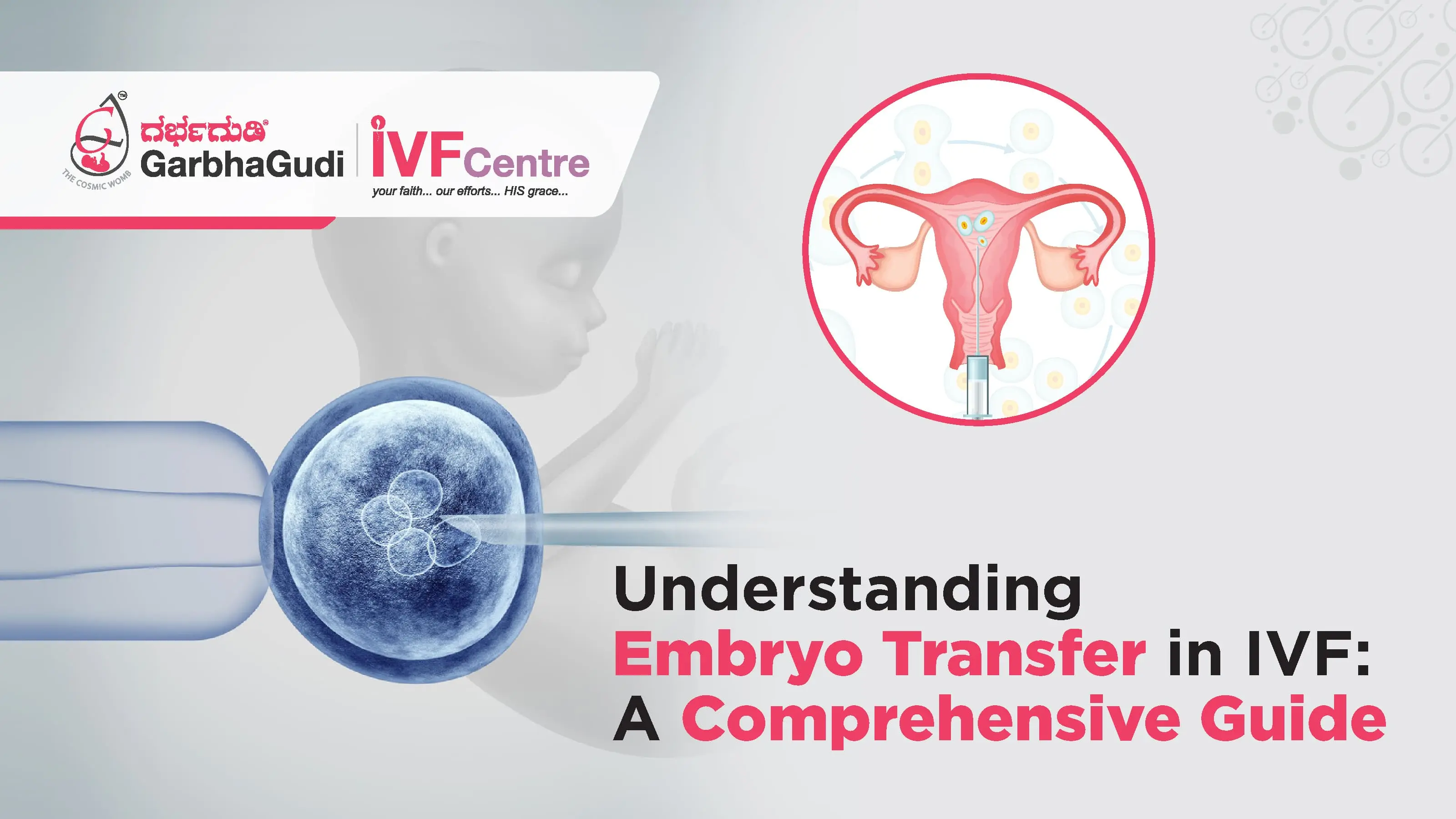 Understanding Embryo Transfer in IVF: A Comprehensive Guide Understanding Embryo Transfer in IVF: A Comprehensive Guide