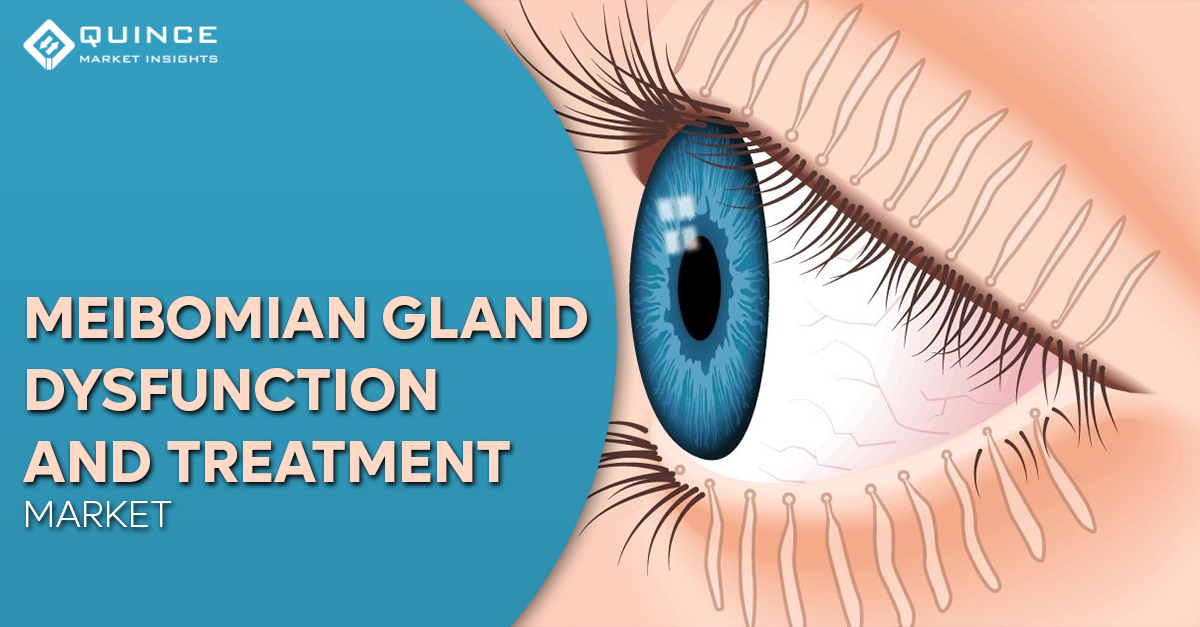 QMI Insights Blog | Recent Developments in Meibomian Gland Dysfunction ...
